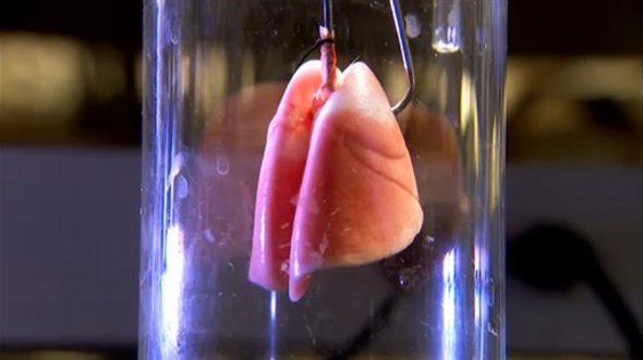 Journal Of Life: 人工器官及幹細胞技術結合DNA疾病掃描將啟動人類壽命延長 ( Growing New Organs ...